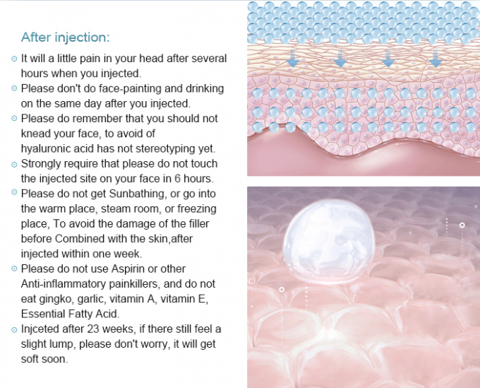 10ml non cross linked hyaluronic acid injection dermal filler for fine ...